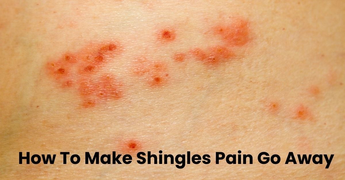 How To Make Shingles Pain Go Away | Sleep Tonight, Hurt Less