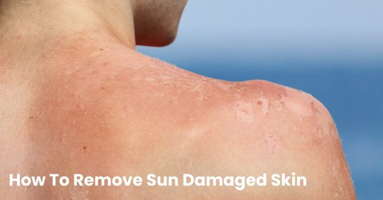 How To Remove Sun Damaged Skin | Real Fixes That Show Up