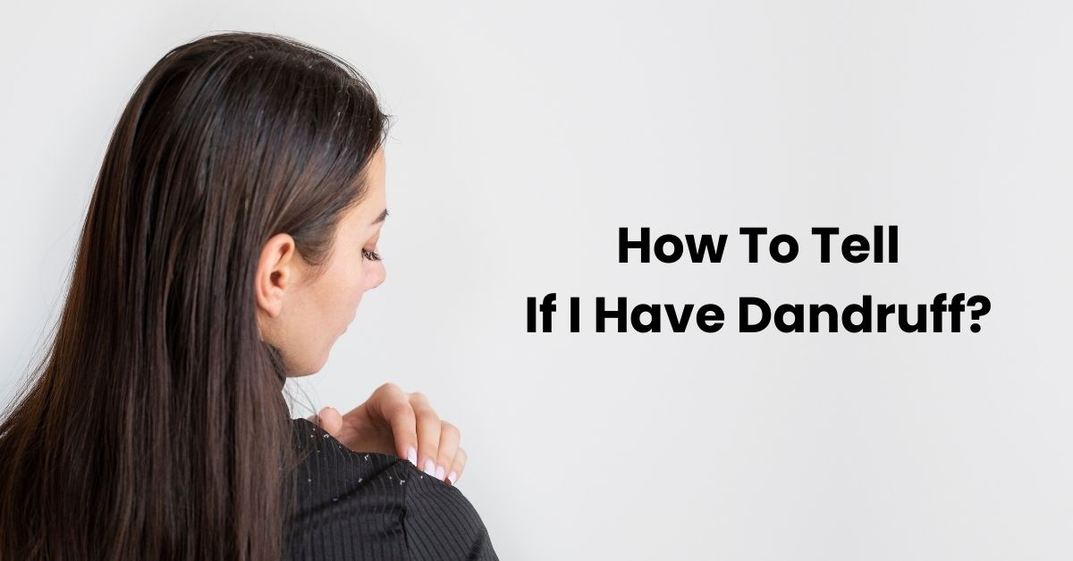 How To Tell If I Have Dandruff? | Signs You Can Check Today