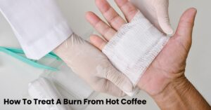 How To Treat A Burn From Hot Coffee | Calm Steps That Heal
