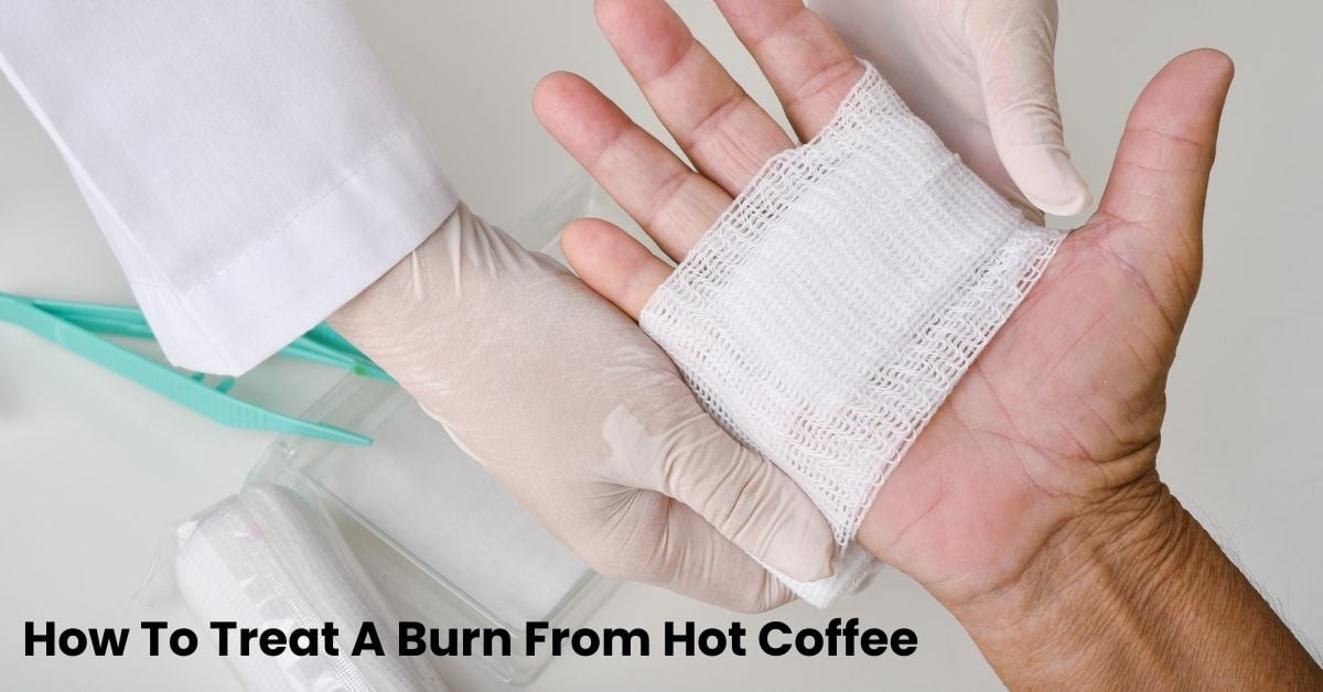 How To Treat A Burn From Hot Coffee | Calm Steps That Heal