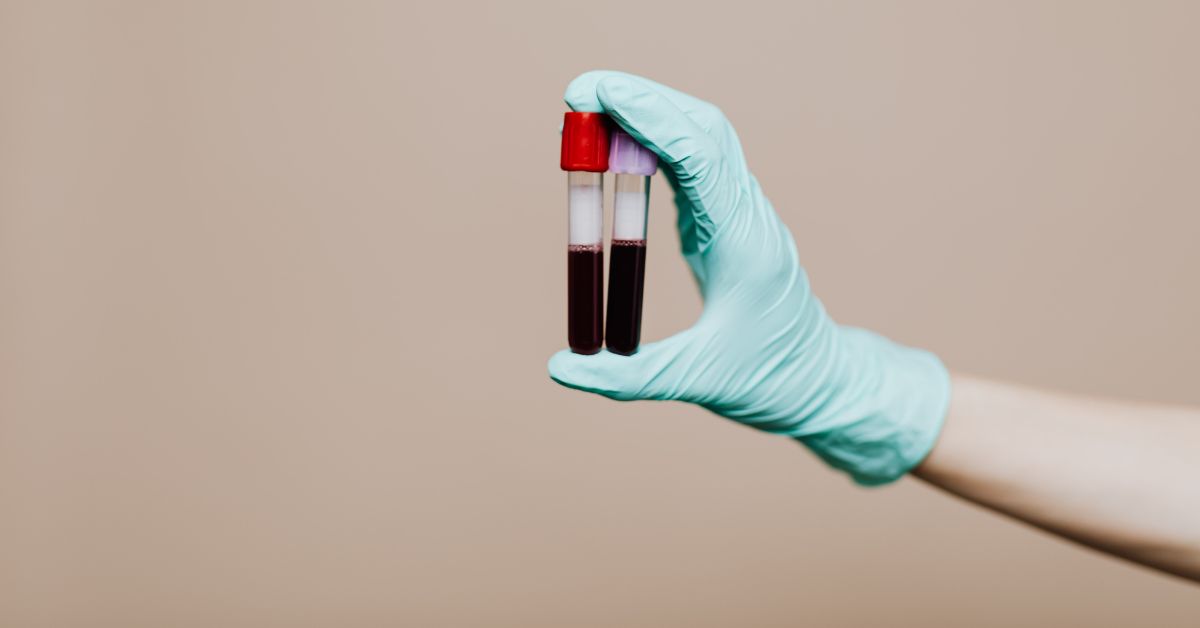 What Blood Tests Show Alcohol Use? | Windows And Limits